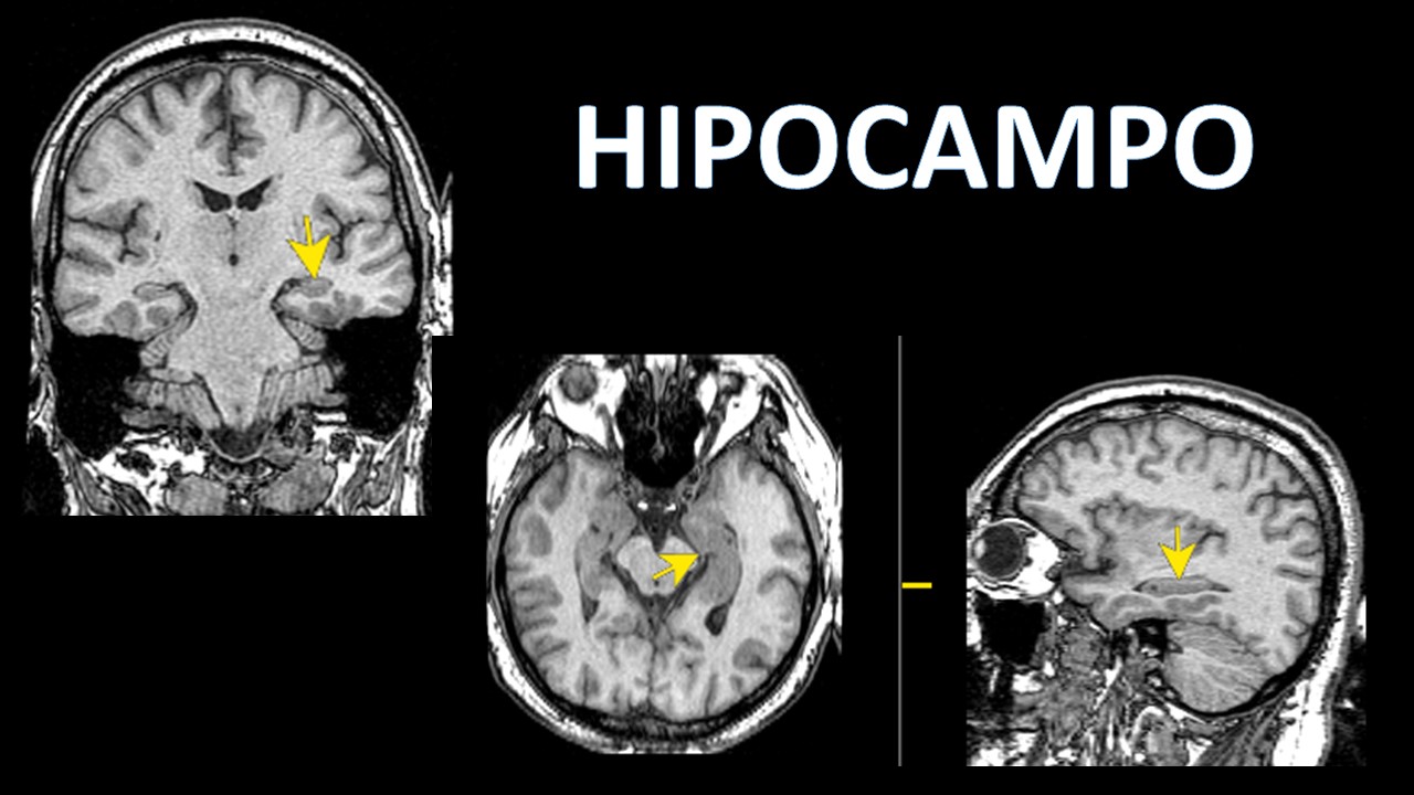 HIPOCAMPO: una pequeña y compleja estructura en la profundidad de ...